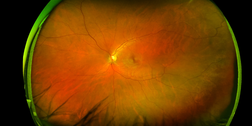Study of Retinal Clock activity in zebrafish per2 Mutants